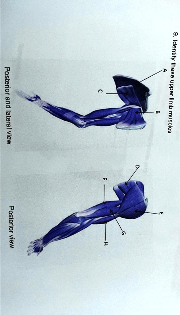 identify these upper limb muscles posterior and lateral view posterior ...