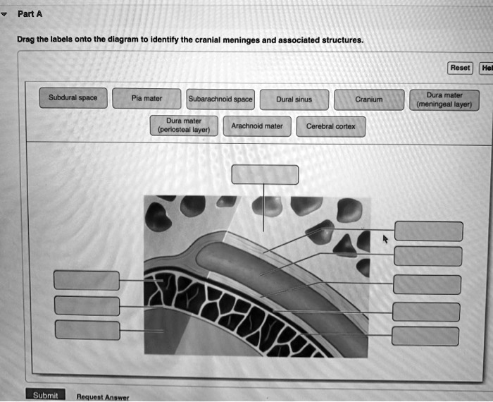 SOLVED: Drag the labels onto the diagram to identify the cranial meninges and associated ...