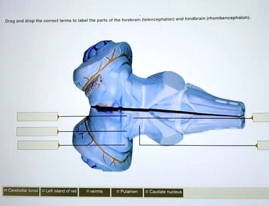 Drag and drop the correct terms to label the parts of the forebrain ...