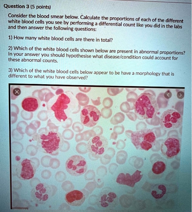 SOLVED: Question 3 (5 points): Consider the blood smear below ...