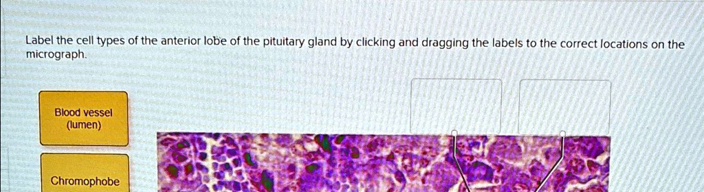 Label the cell types of the anterior lobe of the pituitary gland by ...