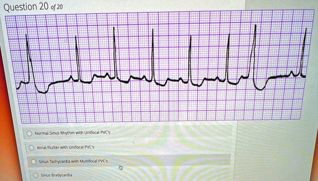 question 20 of 20 normal sinus rhythm with unifocal pvcs atrial flutter ...