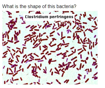 SOLVED: What is the shape of this bacteria? Clostridium perfringens