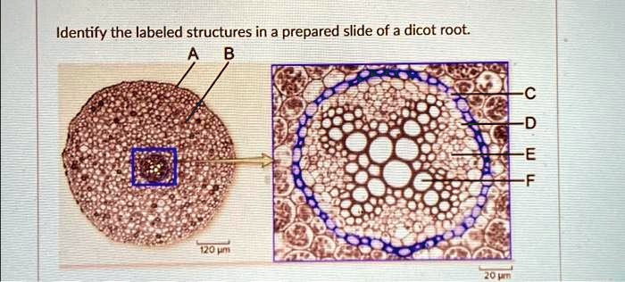Identify the labeled structures in a prepared slide of a dicot root. A B C D E F 120 ?m 20 ?m