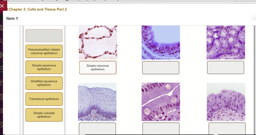 SOLVED: Chapter 3: Cells and Tissues Part 2 Item 1 Pseudostratified ciliated columnar epithelium ...