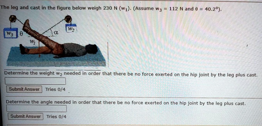 The leg and cast in the figure below weigh 230 N (W1). (Assume W3 112 N ...