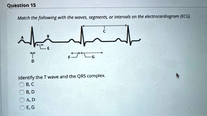Question 15 Match the following with the waves, segments, or intervals ...