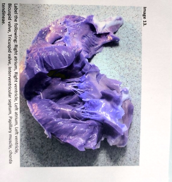 Image 13. Label the following: Right atrium, Right ventricle, Left ...