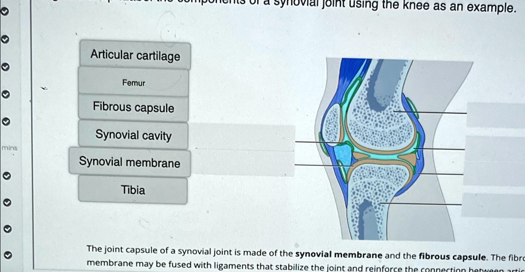Articular cartilage Femur Fibrous capsule Synovial cavity Synovial membrane Tibia The joint ...