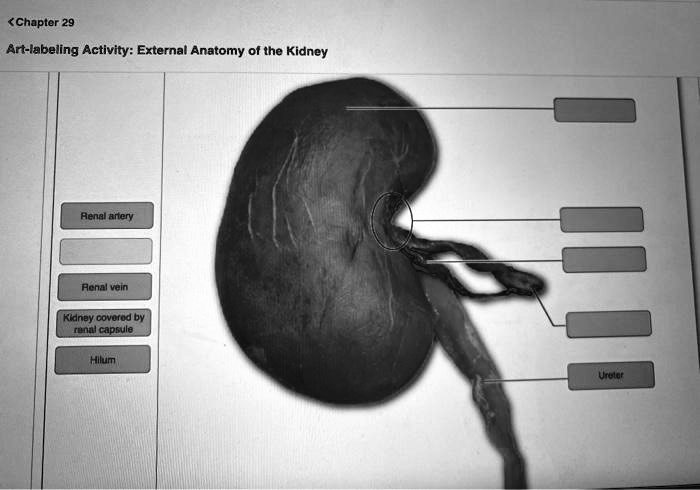 SOLVED: Art-labeling Activity: External Anatomy of the Kidney Renal ... SOLVED: Art-labeling Activity: External Anatomy of the Kidney Renal ...