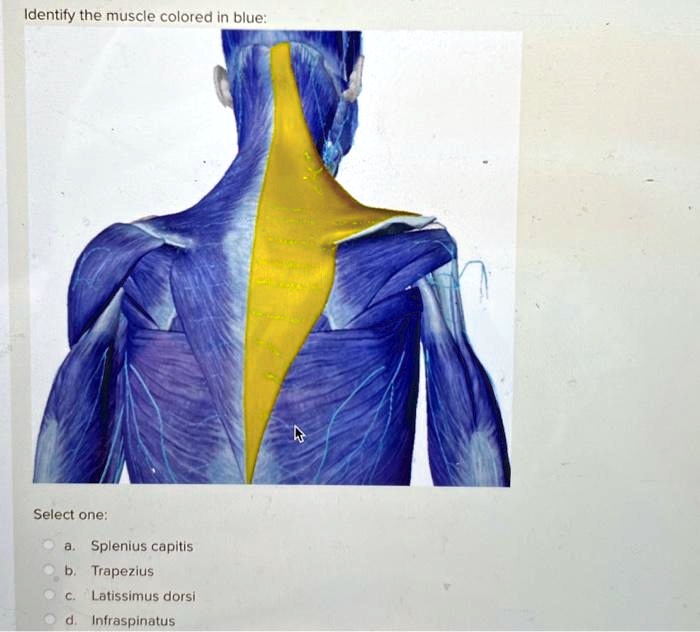 SOLVED: Identify the muscle colored in blue: Select one: a. Splenius ... SOLVED: Identify the muscle colored in blue: Select one: a. Splenius ...