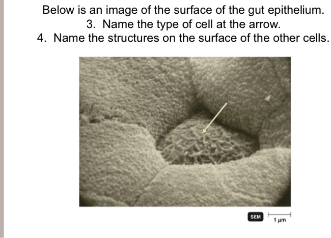 SOLVED: Below is an image of the surface of the gut epithelium 3 Name ...