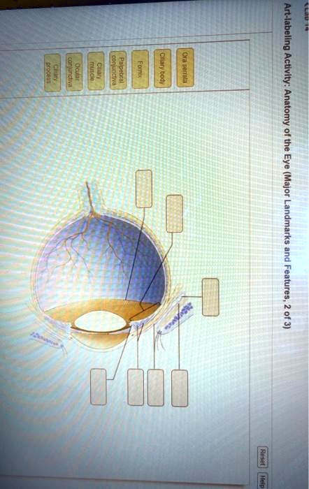 SOLVED: Art-labeling Activity: Anatomy of the Eye (Major Landmarks and ...