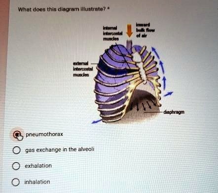 SOLVED: What does this diagram illustrate? * pneumothorax gas exchange ...