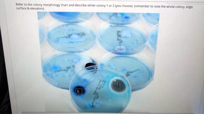 Refer to the colony morphology chart and describe either colony surface ...