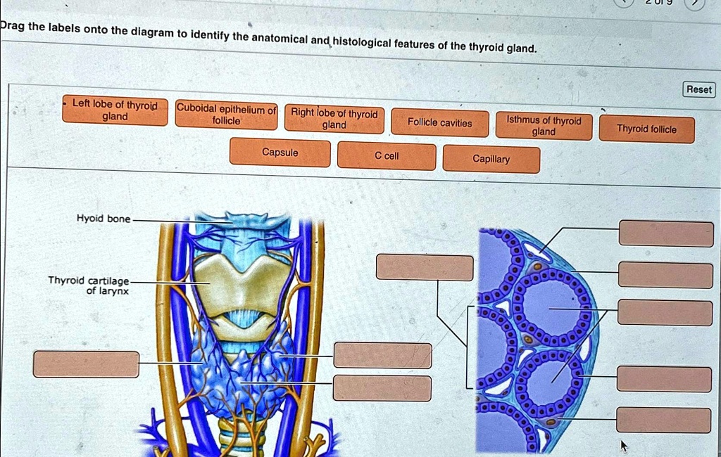 Drag the labels onto the diagram to identify the anatomical and ...