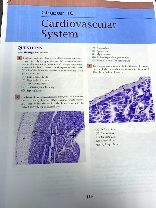 SOLVED: Chapter 10: Cardiovascular System QUESTIONS: Select the correct ...
