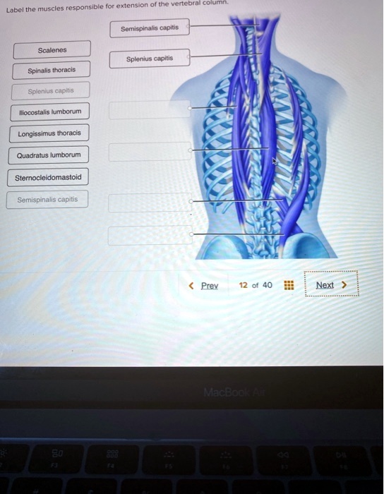 SOLVED: Label the muscles responsible for extension of the vertebral ...