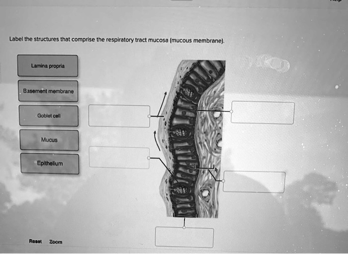 Label the structures that comprise the respiratory tract mucosa (mucous ...