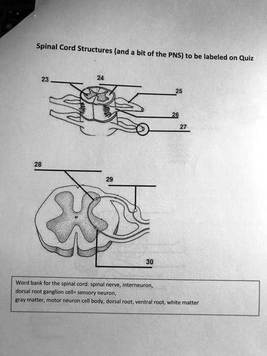 SOLVED: Spinal Cord Structures (and a bit of the PNS) to be labeled on ...