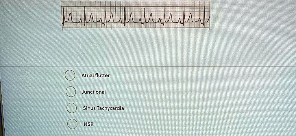 SOLVED: Texts: What is this rhythm? Atrial flutter Junctional Sinus ...