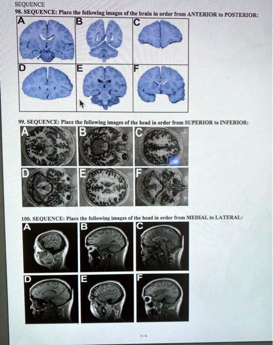 SEQUENCE 98. SEQUENCE: Place the following images of the brain in order ...