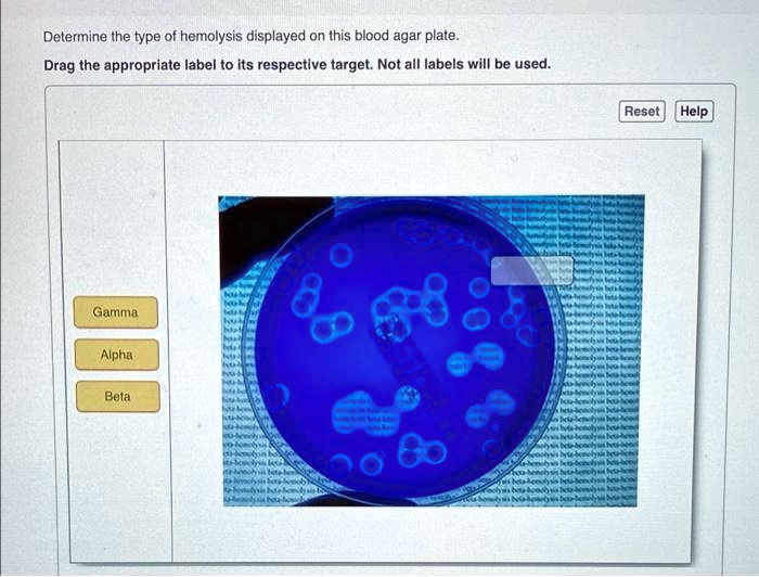 Determine the type of hemolysis displayed on this blood agar...