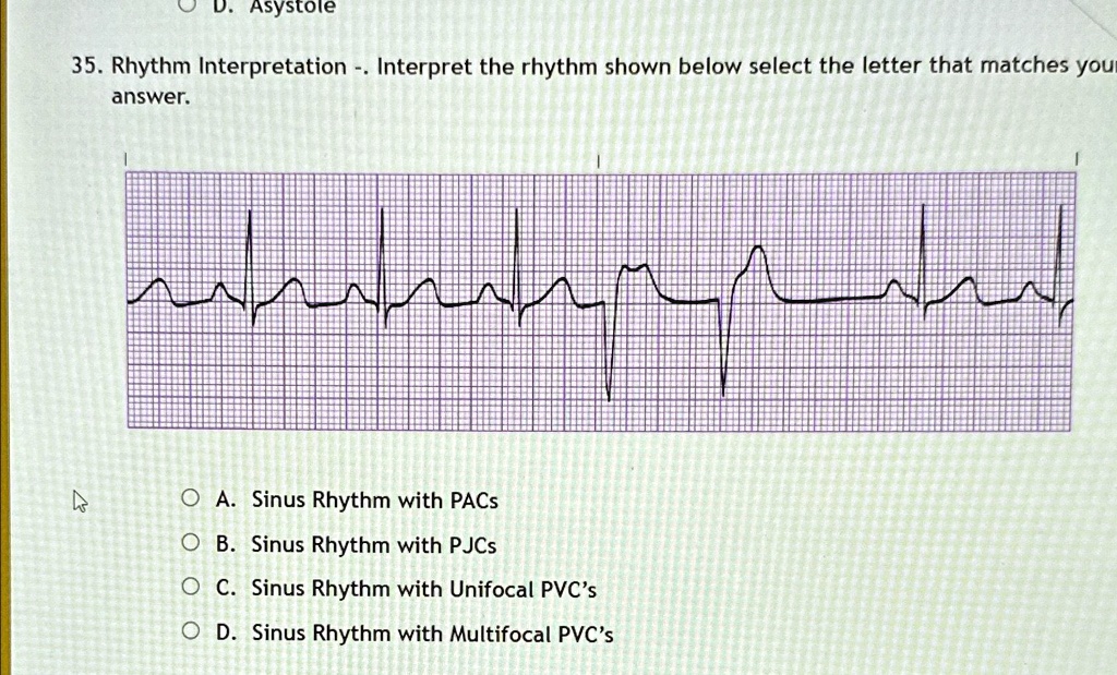 SOLVED: Rhythm Interpretation - Interpret the rhythm shown below and ...