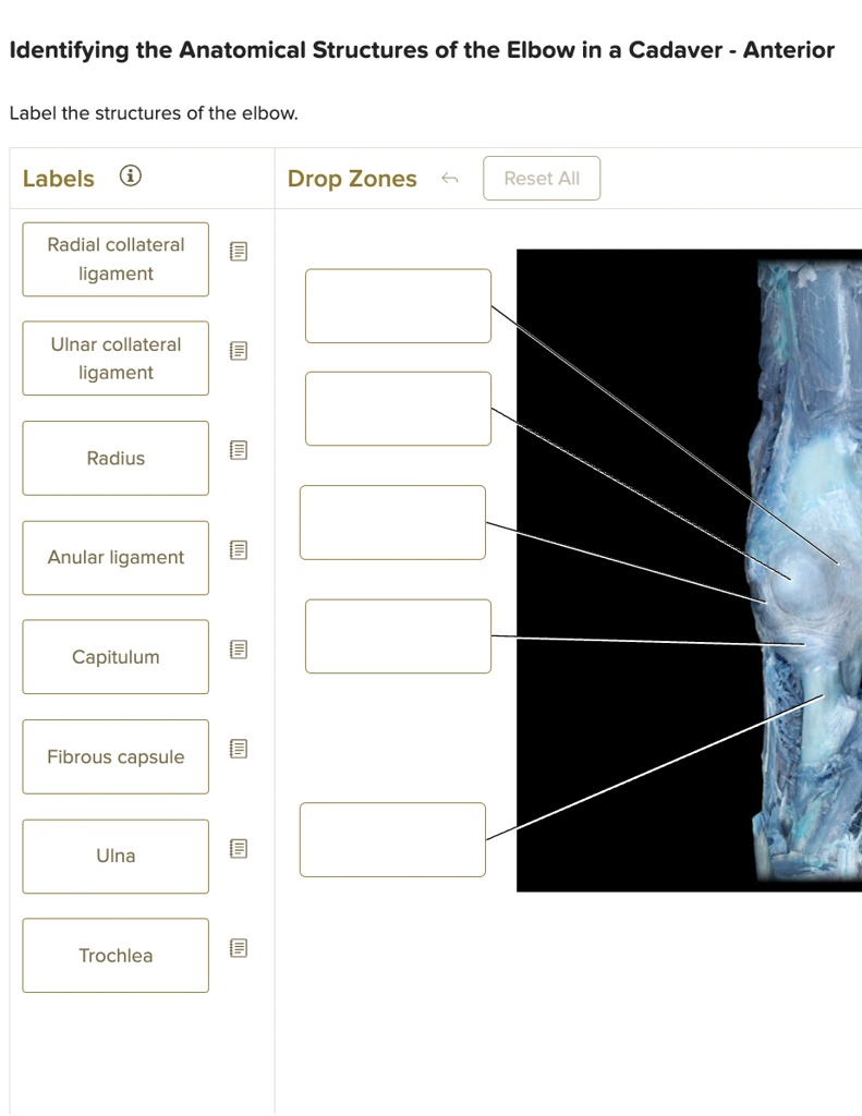 Identifying the Anatomical Structures of the Elbow in a Cadaver ...