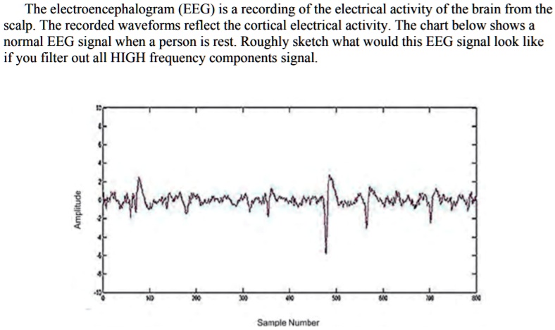 SOLVED: The electroencephalogram (EEG) is a recording of the electrical ...