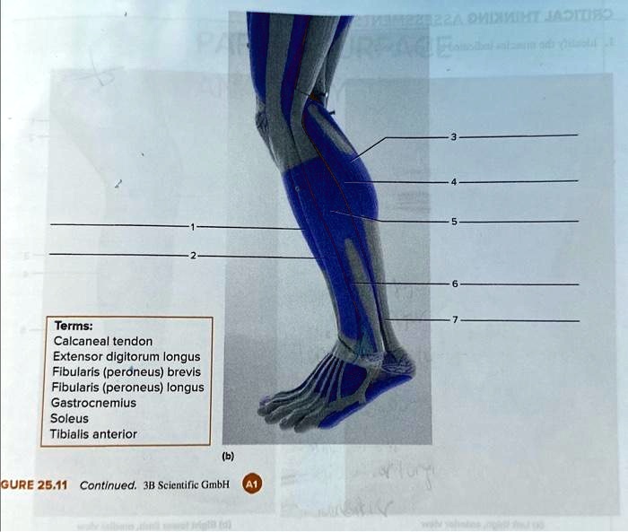 SOLVED: Texts: Terms: Calcaneal tendon, Extensor digitorum longus ...