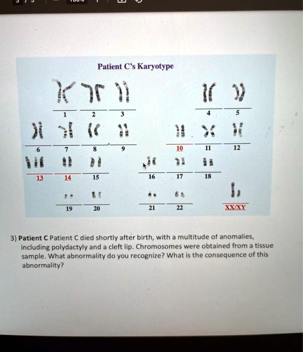SOLVED: Patient C's Karyotype Patient C died shortly after birth with a ...
