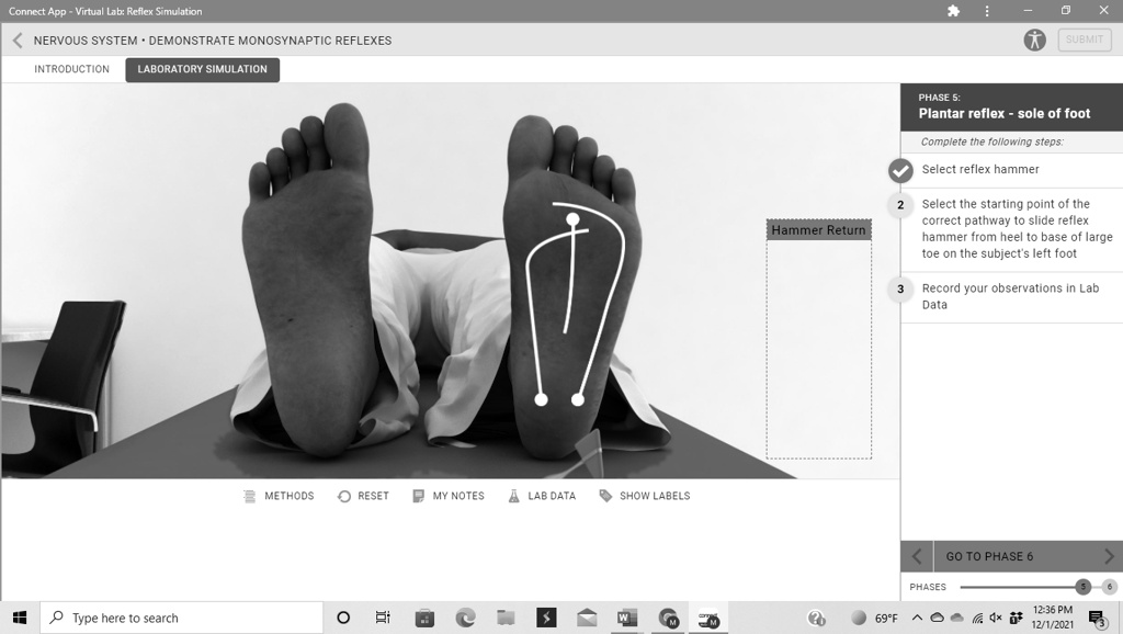 Connect App - Virtual Lab: Reflex Simulation