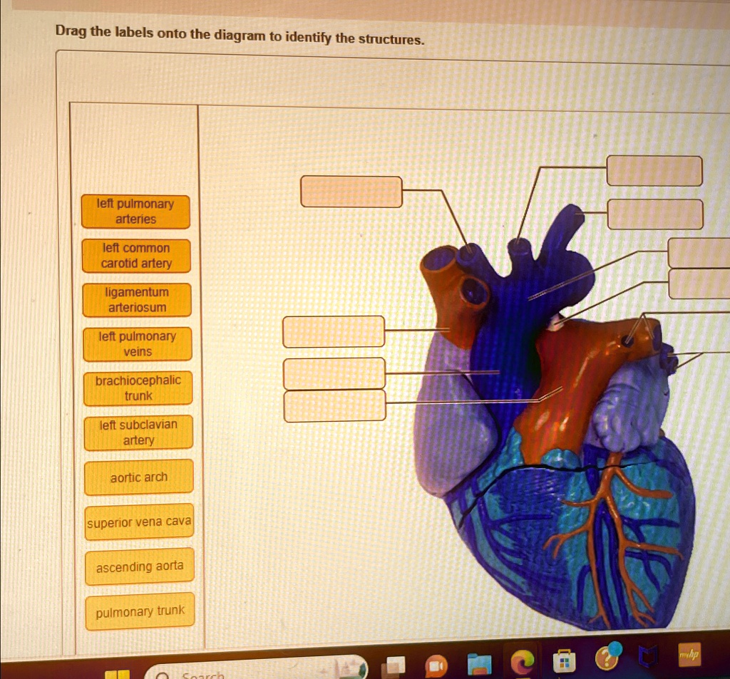Drag the labels onto the diagram to identify the structures. left pulmonary arteries left common ...