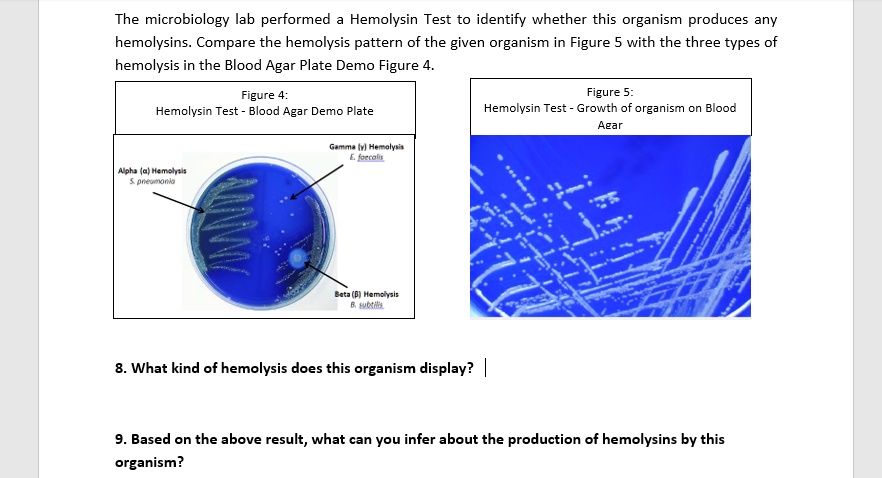 SOLVED: The microbiology lab performed Hemolysin Test to identify ...