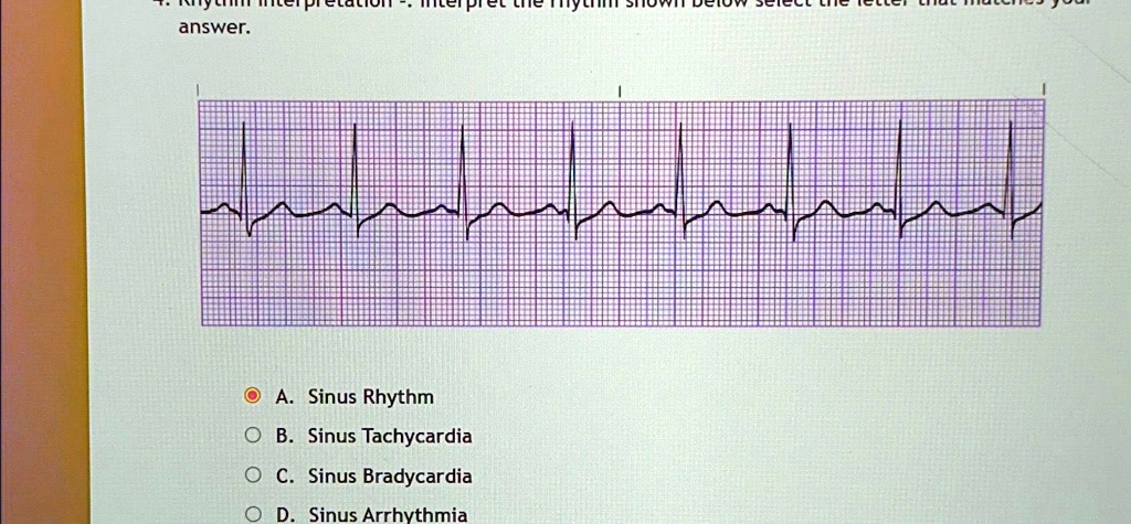 answer 1 a sinus rhythm b sinus tachycardia c sinus bradycardia d sinus ...