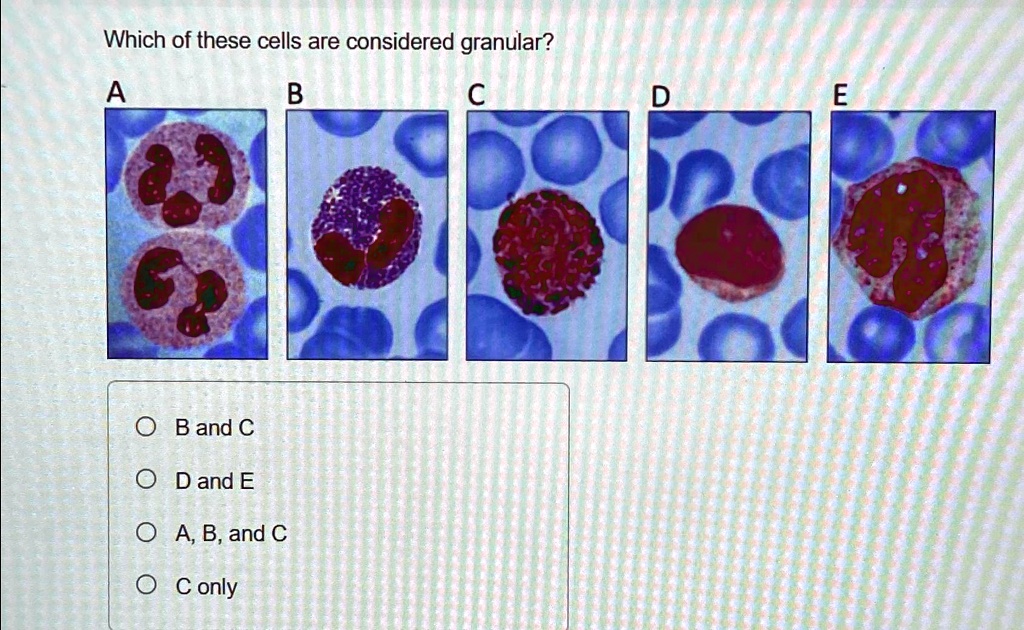 which of these cells are considered granular a b c d e b and c d and e ...