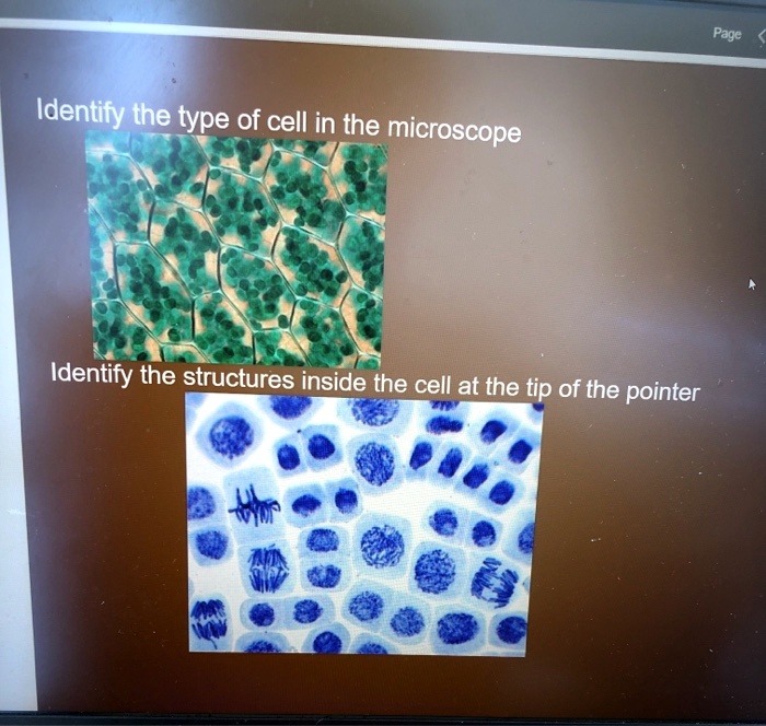 SOLVED: Identify the type of cell in the microscope Identify the structures inside the cell at ...