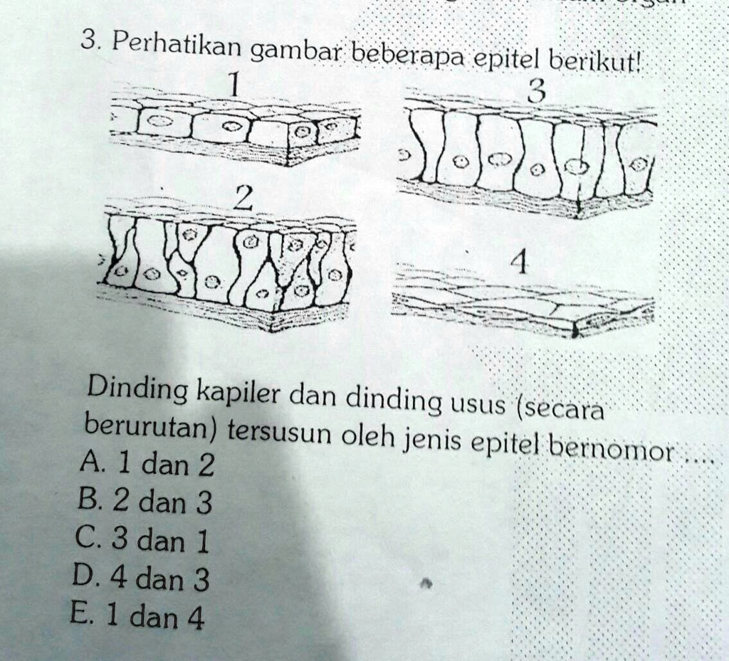 SOLVED: dinding kapiler dan dinding usus (secara berurutan) tersusun ...