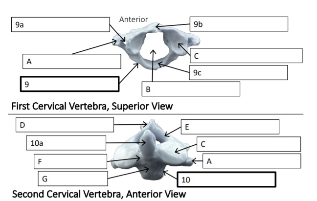 anterior 9b first cervical vertebra superior view 10a 10 second ...