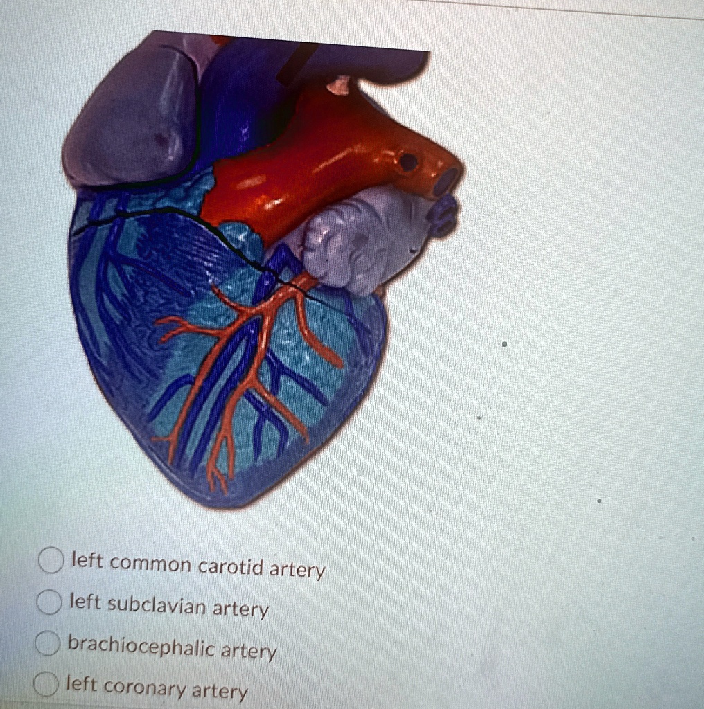 left common carotid artery left subclavian artery brachiocephalic artery left coronary artery 53753