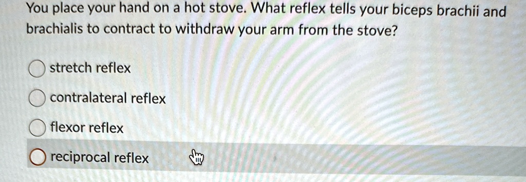 You place your hand on a hot stove. What reflex tells your biceps ...