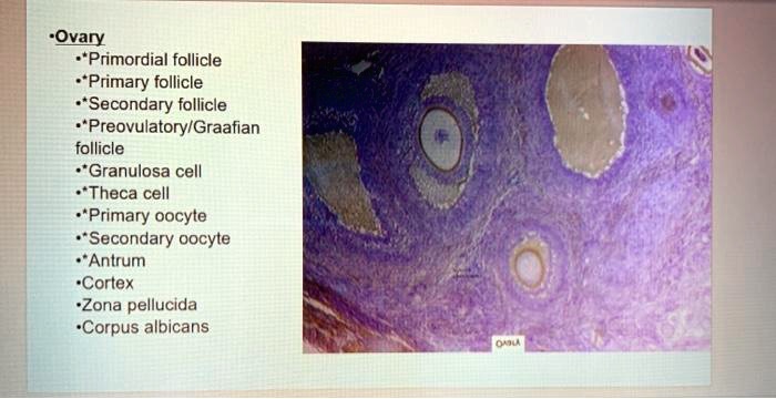 - Ovary: Primordial follicle, Primary follicle, Secondary follicle ...