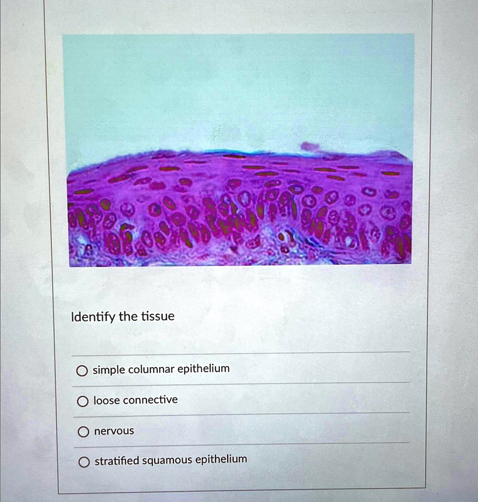 SOLVED: Identify the tissue simple columnar epithelium loose connective ...