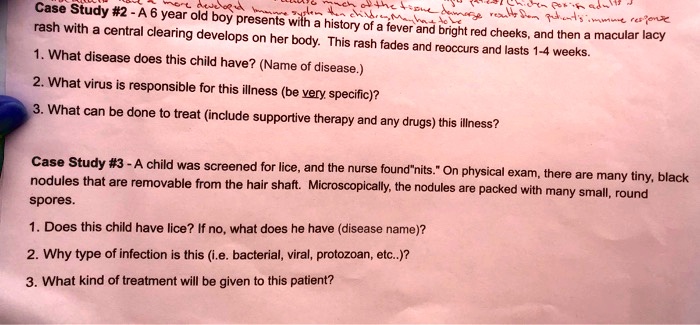 case study 2 a 6 year old 645 boy presents wilh history uoln rash with ...