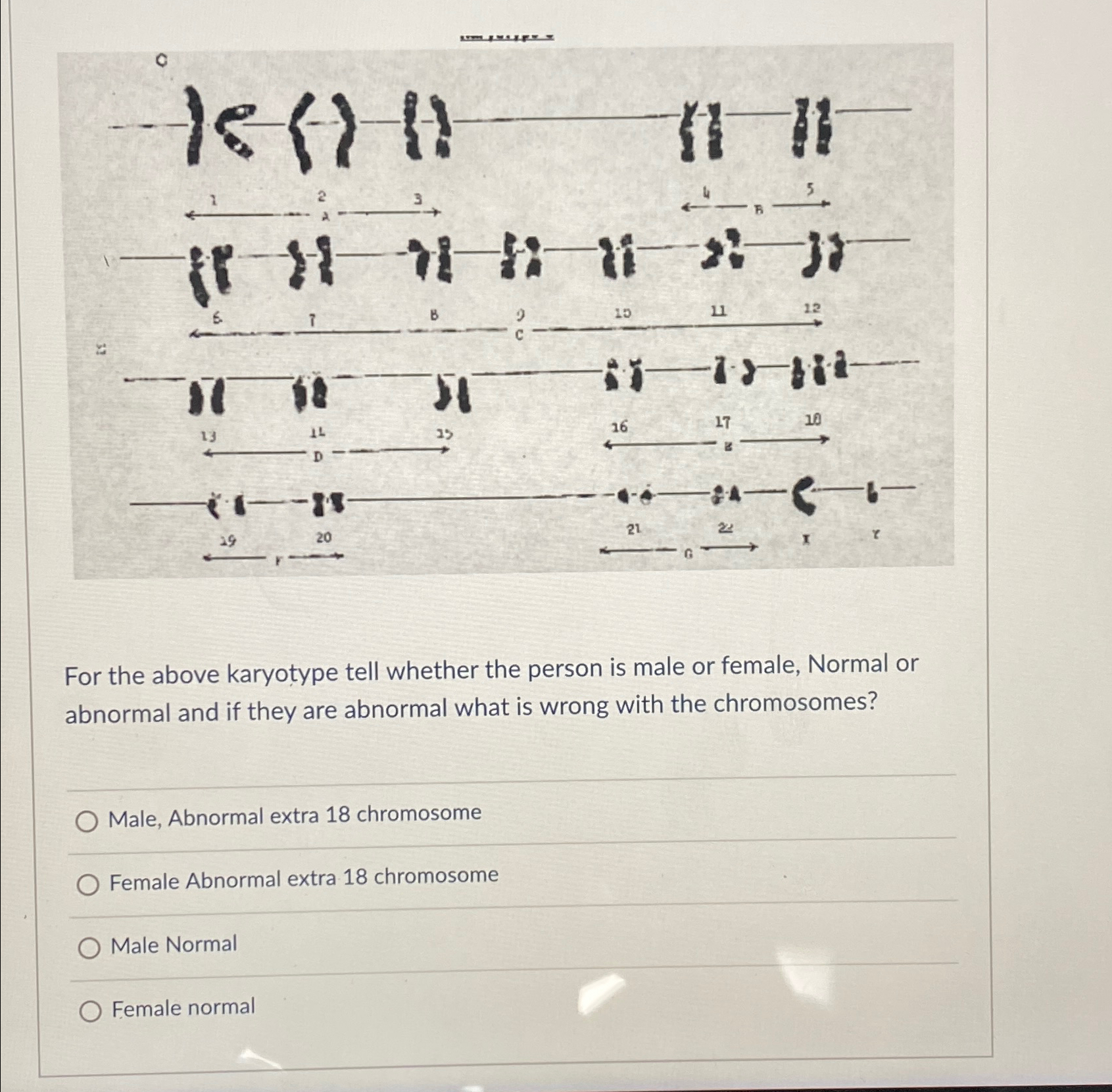 For the above karyotype tell whether the person is male or female ...
