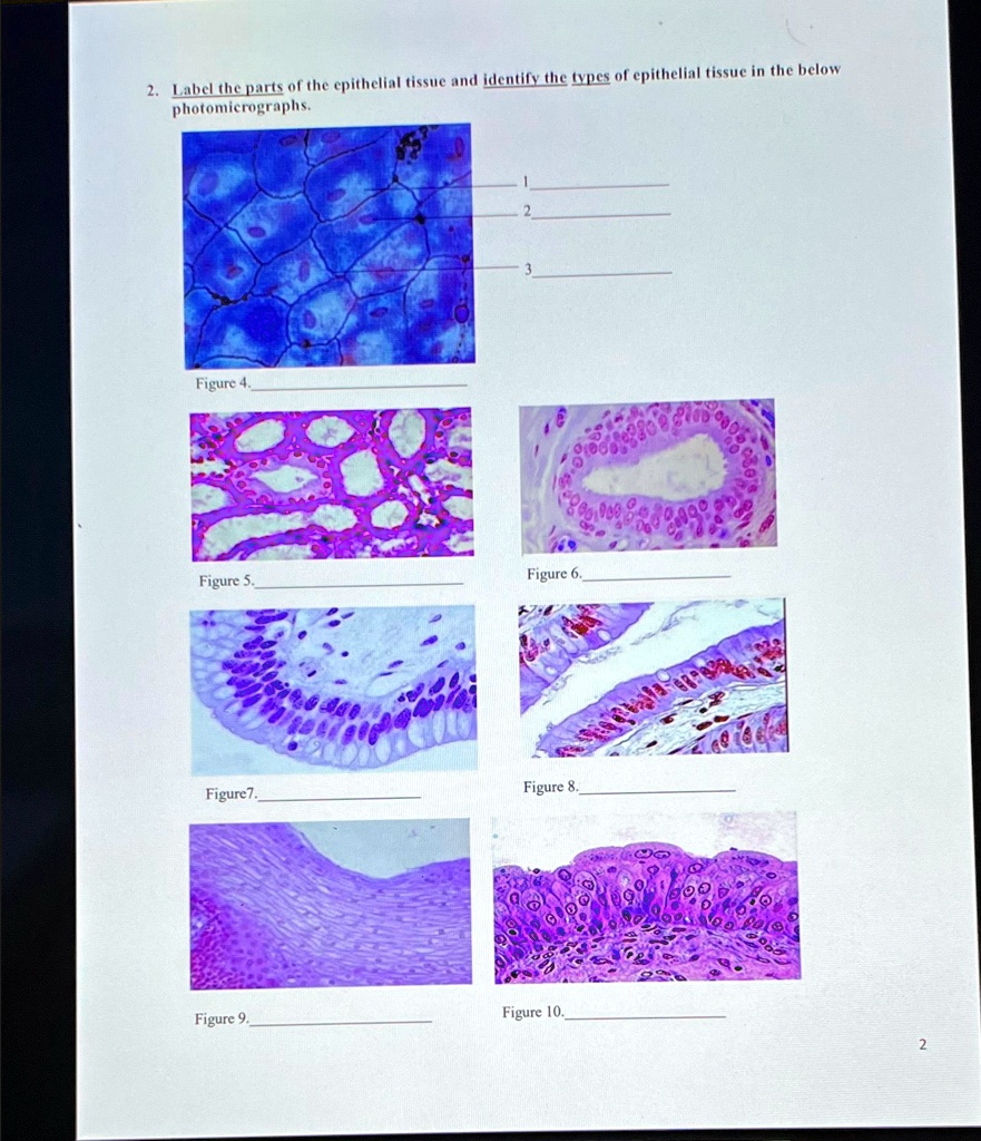 SOLVED: Texts: 1. Label the parts of the epithelial tissue and identify ...