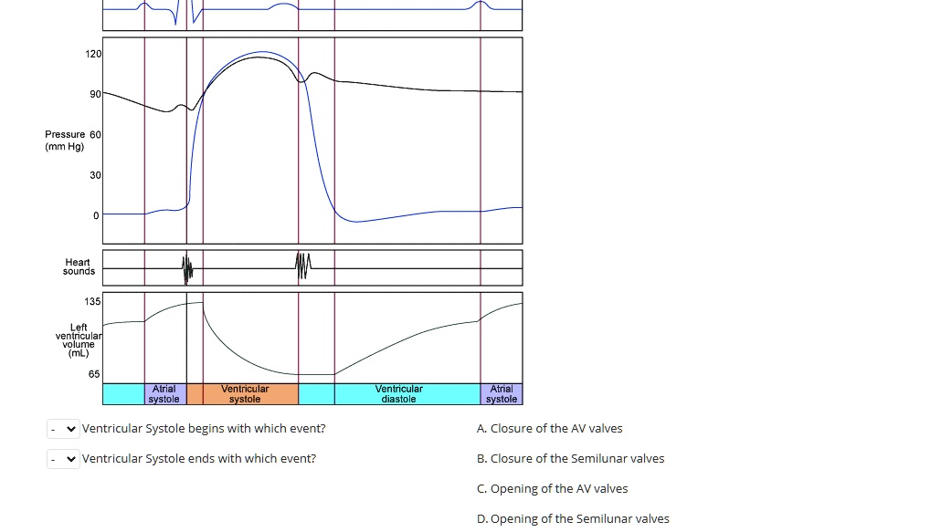 Wiggers Diagram Explained