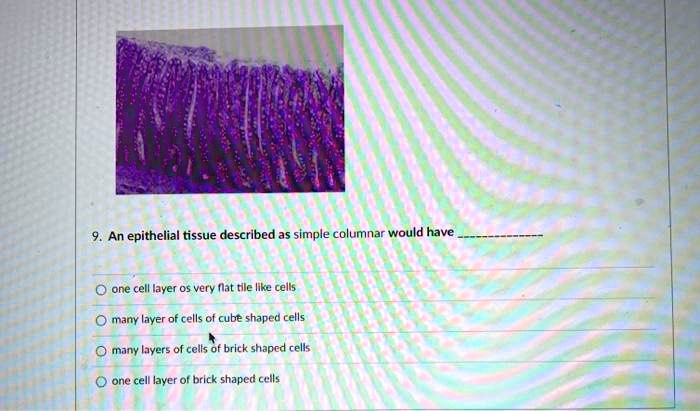 SOLVED: An epithelial tissue described as simple columnar would have ...