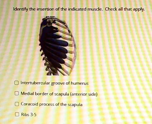 Identify the insertion of the indicated muscle. Check all that apply ...
